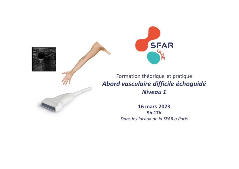 Formation IADE - Pose de voie veineuse périphérique sous échographie ...